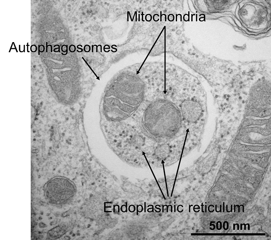 MIZUSHIMA Laboratory | Our research focuses on "AUTOPHAGY", an ...